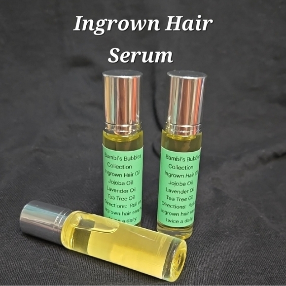 Hand Crafted | Skincare | Hand Crafted Ingrown Hair Serum Ml Roll On ...